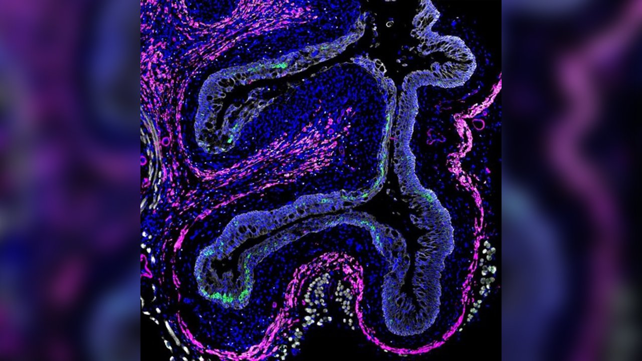 Worm infestation in intestine has a remote effect on viral defenses ...