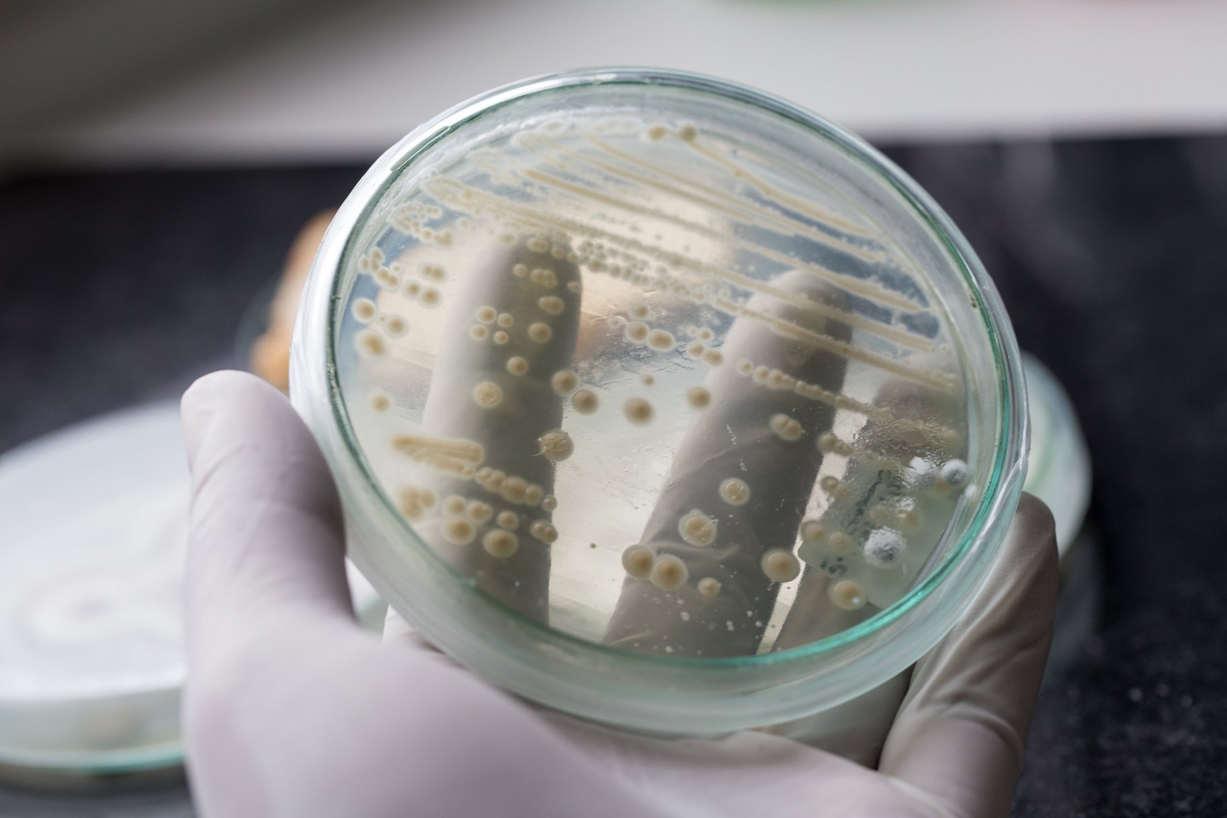 Scynexis announces FDA approval of Brexafemme as the first and only ...